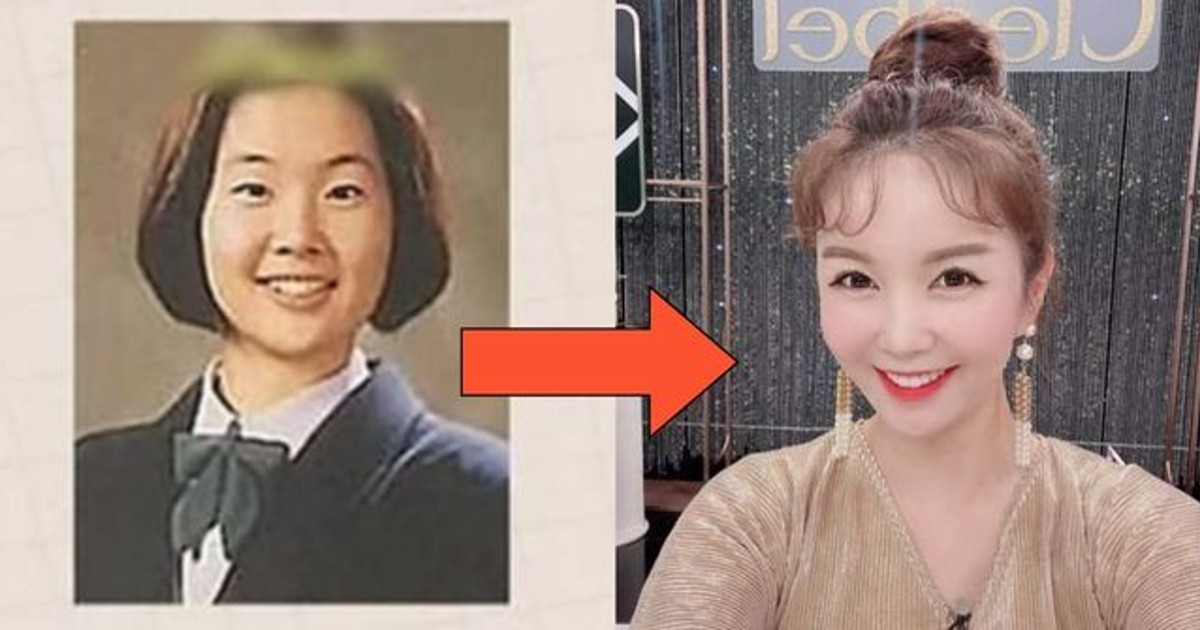 눈만 5번 성형 수술 했다 장영란 성형 전 모습 깜짝 공개하며 매니저들에게 퀴즈까지 무슨 일